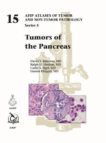 TUMORS OF THE Pancreas (AFIP Atlas of Tumor and Non-Tumor Pathology, Series 5) £183.00 - PicClick UK