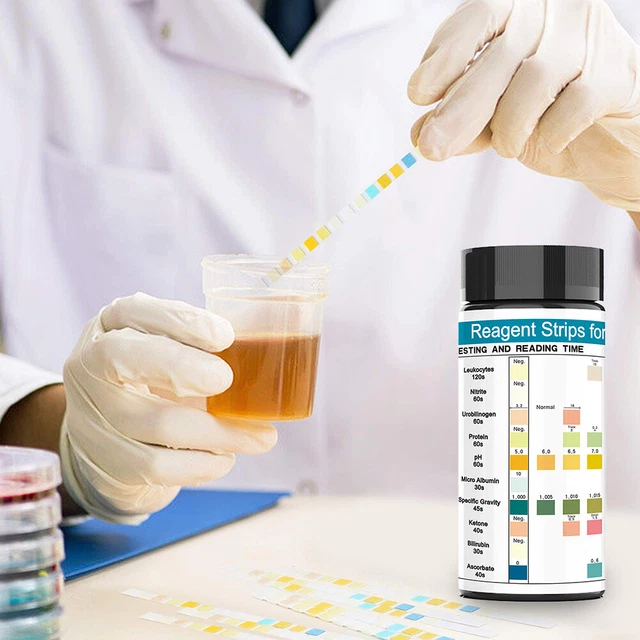 100 STRIPS URINE Urinalysis Test Strips Useful 10 Parameters PH Test ...