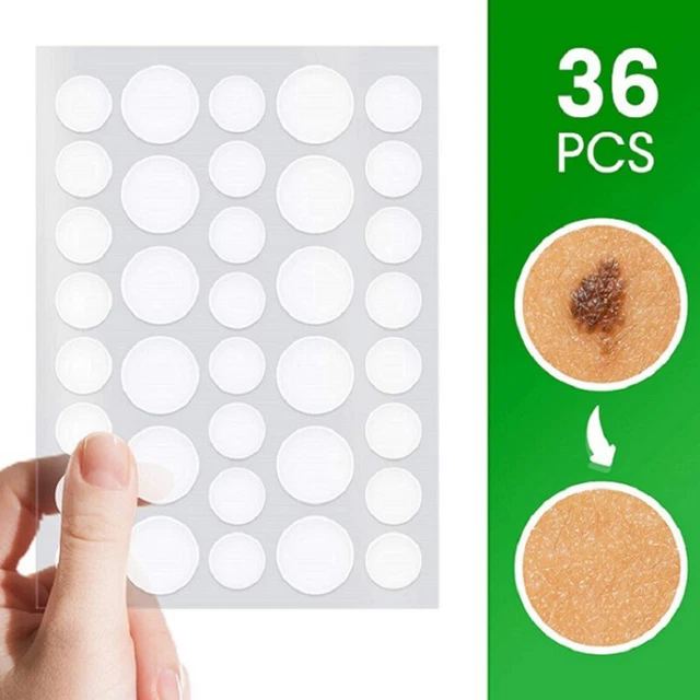 SKIN TAG REMOVER Patch Ance Pimple Patch Anti-infection Quick Absorb ...