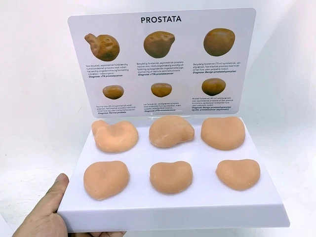 Male Prostate Model Genital Anatomy Male Pelvic Sagittal Section