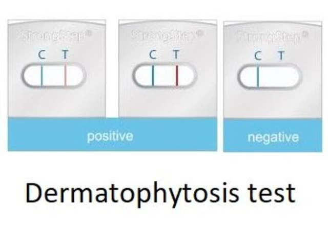 DERMATOPHYTOSIS TEST RINGWORM tinea corporis fungus SWAB test £25.00 ...