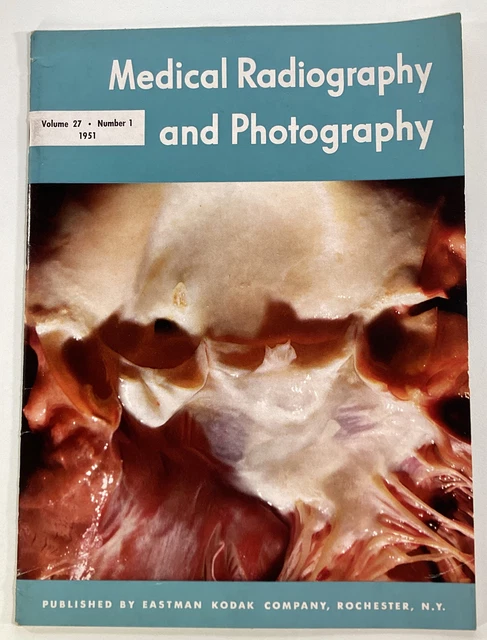 RADIOLOGY MAGAZINE 1951 Radiography Photography Robarts Hip Cleft ...