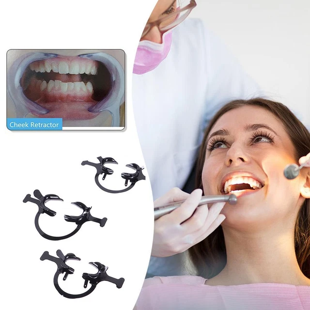 MOUTH SPREADER MOUTH Opener Intraoral Retractor Dental Expand Retractor ...