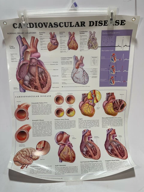 GRAFICO DELLE MALATTIE cardiovascolari di Anatomical Chart Co ...