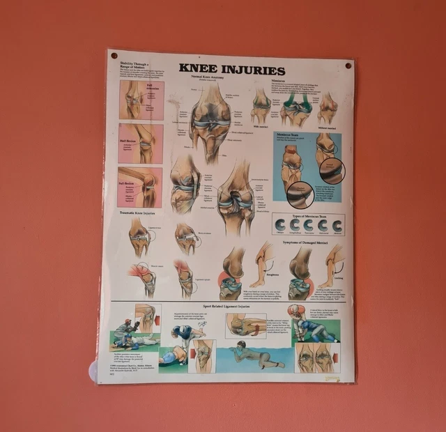 ANATOMICAL MEDICAL POSTERS The Anatomical Chart Co - Knee Injuries £21. ...