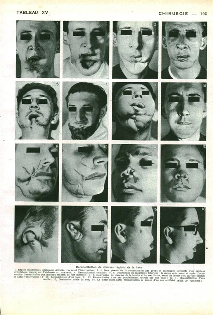 CABINET DE CURIOSITÉ anatomie humaine reconstitution face issue du ...