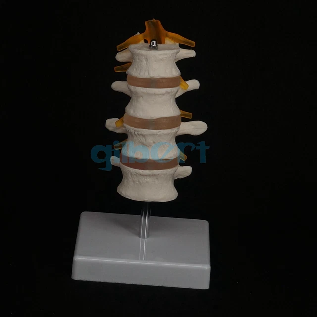 LIFE FOUR THREE Section Lumbar Spine Skeleton Model with Stand Medical ...