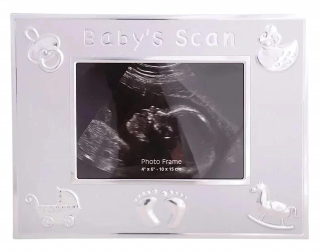 ULTRASOUND SCAN BABY Photo Frame Gift Pregnancy Announcement Shower ...