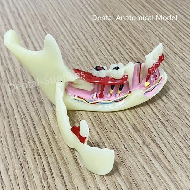 DENTAL ANATOMICAL MANDIBULAR Teaching Model Anatomy Of Gums Study ...