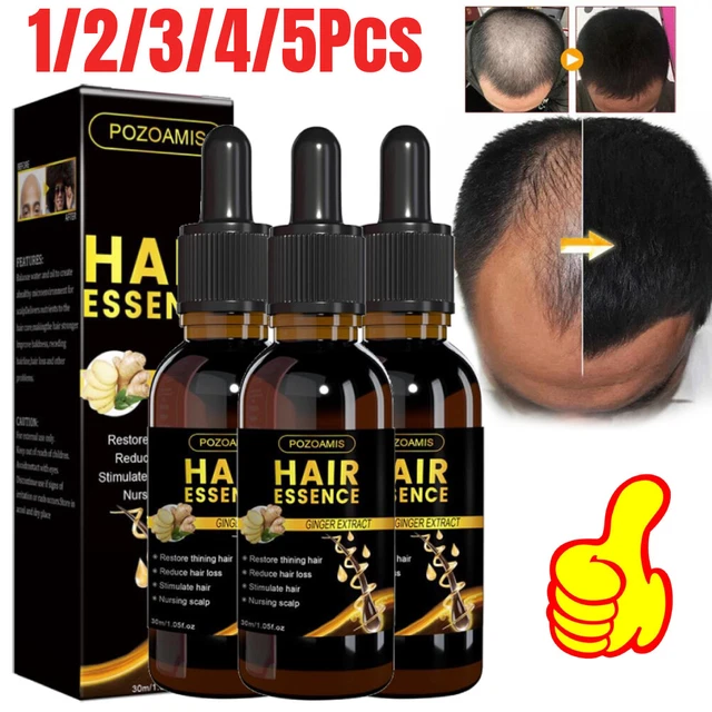 1 5pcs Fast Hair Growth Dense Regrowth Ginger Serum Oil Anti Loss