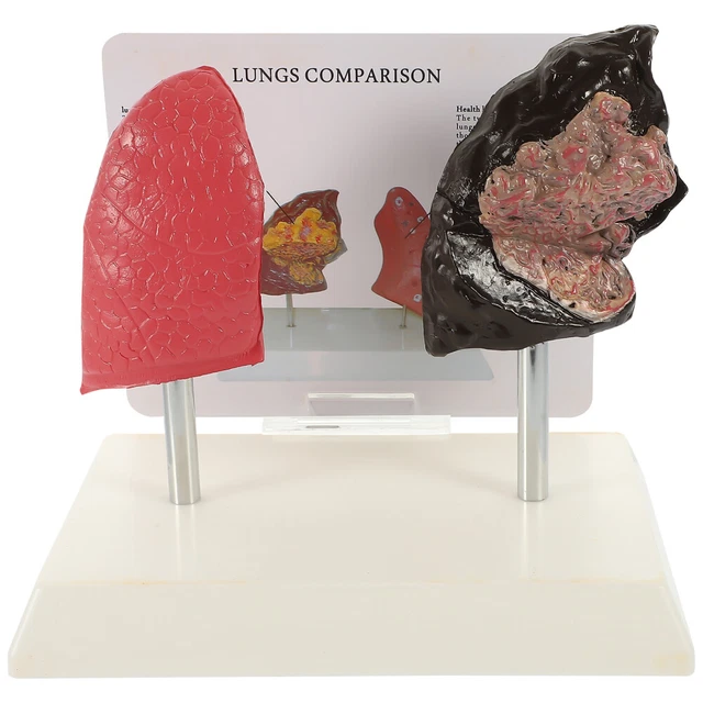 MEDICAL LUNG MODEL Human Body Organs Model Lung Function Demonstration ...