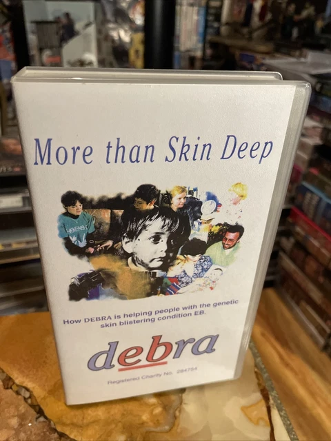 MORE THAN SKIN Deep Debra Vhs Video Short Documentary £6.00 - PicClick UK