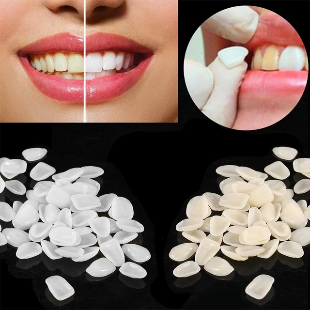 TEMPORARY CROWNS POSTERIORS Anterior Molar Resin Tooth Teeth Caps ...