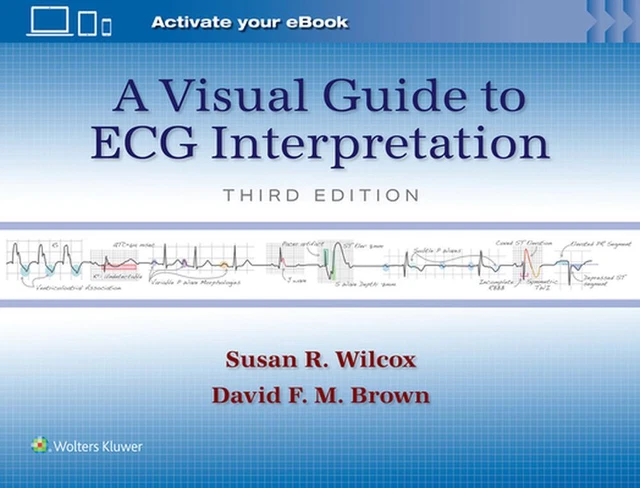 A VISUAL GUIDE to ECG Interpretation: Print + eBook with Multimedia by ...