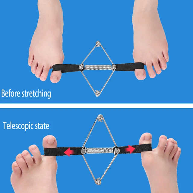 HALLUX VALGUS CORRECTOR Big Toe Bunion Recovery Exercise Brace Splint ...
