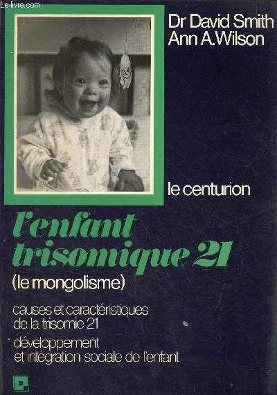 L'ENFANT TRISOMIQUE 21 (le mongolisme) - Causes et caractéristiqu EUR ...