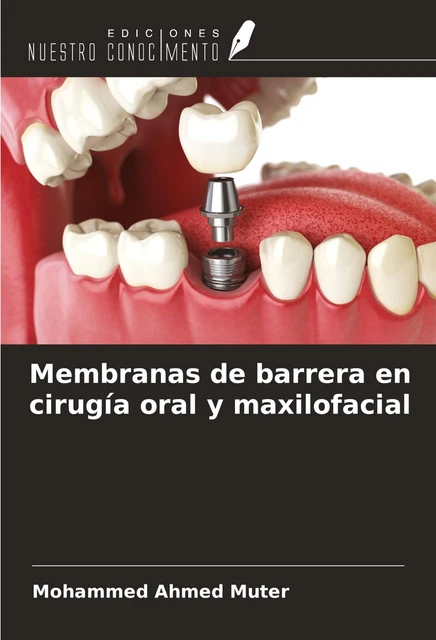 MEMBRANAS DE BARRERA en cirugía oral y maxilofacial Mohammed Ahmed Muter Buch EUR 44,90 ...