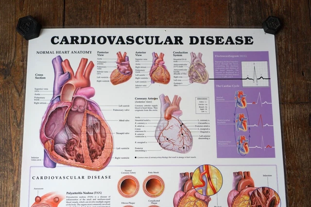 Medical Wall Charts The Human Heart Chart (Laminated Understanding The ...