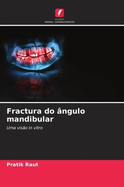 PRATIK RAUT | Fractura do ângulo mandibular | Taschenbuch | Portugiesisch (2022) EUR 26,95 ...