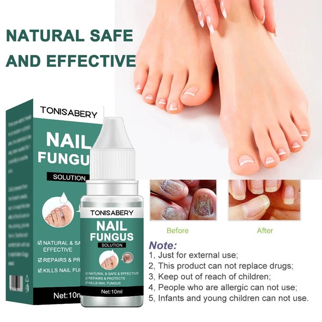 LIQUID NAIL FUNGAL Treatment Onychomycosis Anti Infection Paronychia ...