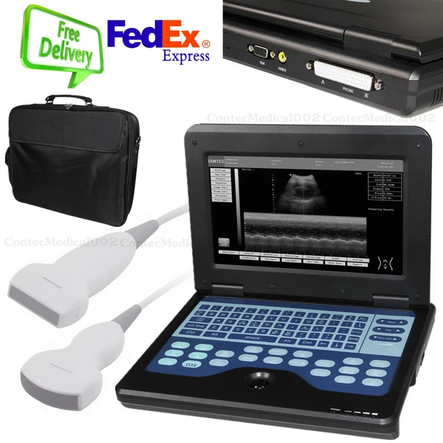 CMS600P2 LAPTOP ULTRASOUND Scanner Notebook Machine with Convex+Linear ...