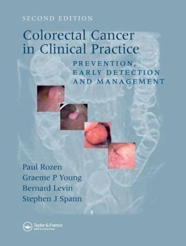Colorectal Cancer In Clinical Practice Prevention Early Detection And