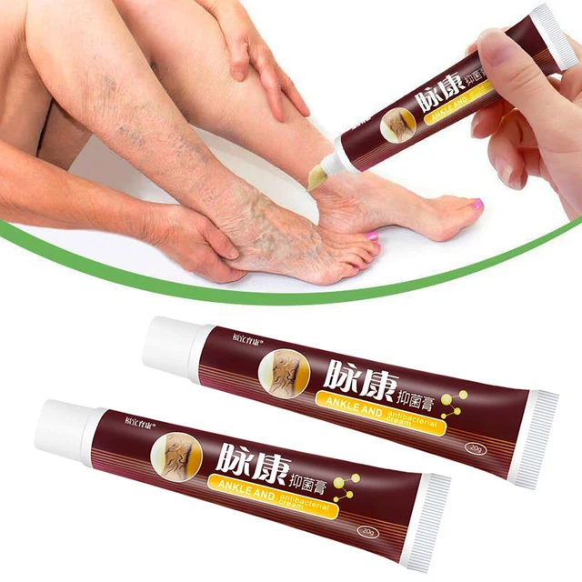 2PC VARICES MEDICAL Cream Testicular Varicocele Ointment Treatment Leg ...