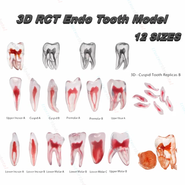 DENTAL RCT 3D Print Endo Training Model Block Practice Replicas Root ...