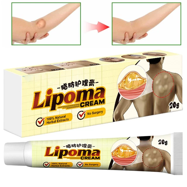 LIPOM-CREME, SICHERE INHALTSSTOFFE, pflanzliche Lipom-Fettklumpen ...