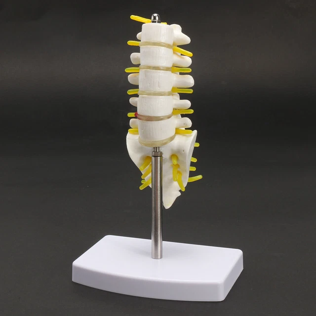 VERTEBRAL COLUMN - New Human Spine Lumbar Anatomy ~l Model Educational ...