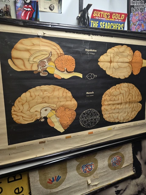 MEDICAL CHART.RARE GERMAN 1960s original vintage. Brain .. Anatomy ...