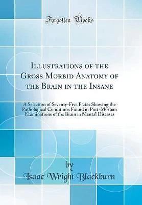 ILLUSTRATIONS OF THE Gross Morbid Anatomy of the Brain in the Insane A ...