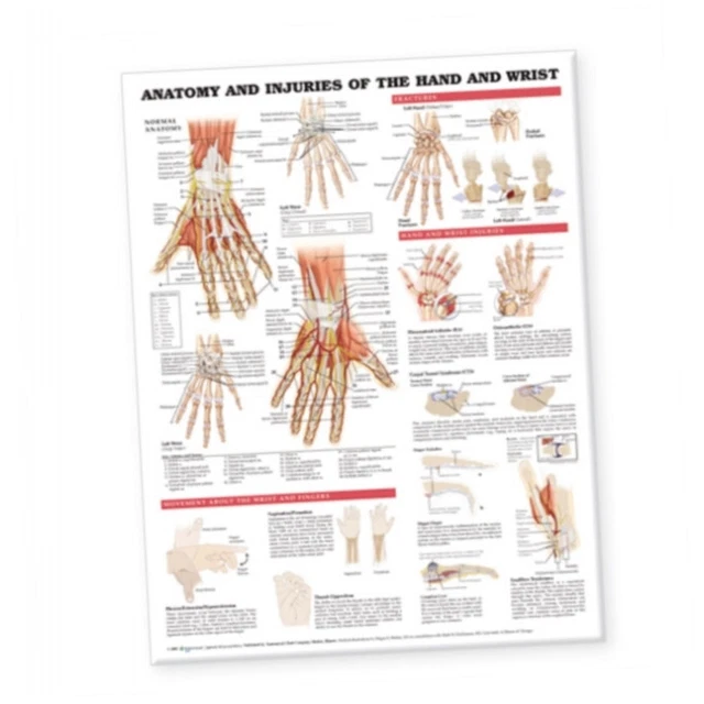 ANATOMY AND INJURIES of the Hand and Wrist Anatomical Chart (Wallchart ...