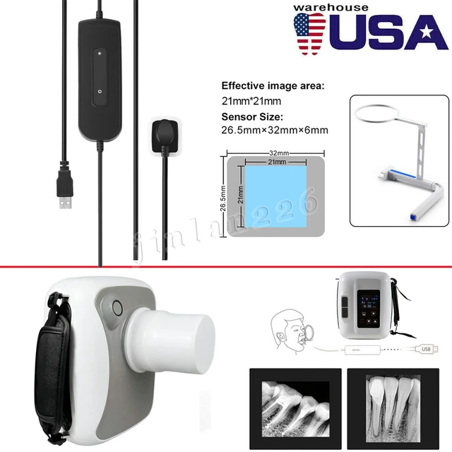 SISTEMA PORTÁTIL DE imágenes dentales sensor digital de rayos X rvg 1.0 ...