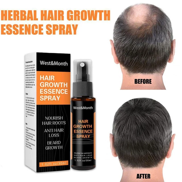 Hair Growth Serum Spray Dense Fast Regrowth Ginger Oil Anti Loss