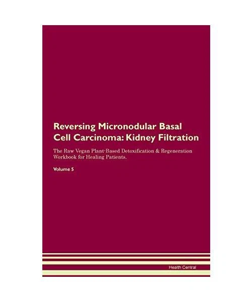 REVERSING MICRONODULAR BASAL Cell Carcinoma: Kidney Filtration The Raw ...