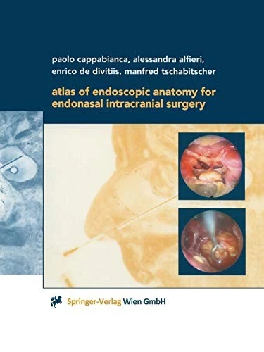 ATLAS OF ENDOSCOPIC Anatomy for Endonasal Intra, Cappabianca, Paolo