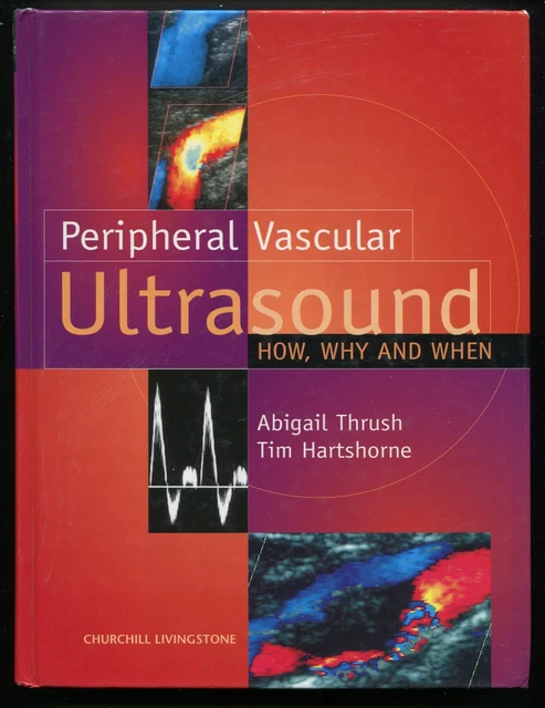 PERIPHERAL VASCULAR ULTRASOUND : How, Why and When by Thrush ...