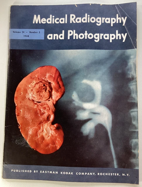 RADIOLOGY MAGAZINE 1948 Radiography Photography Bone Hand Kidney Cases ...