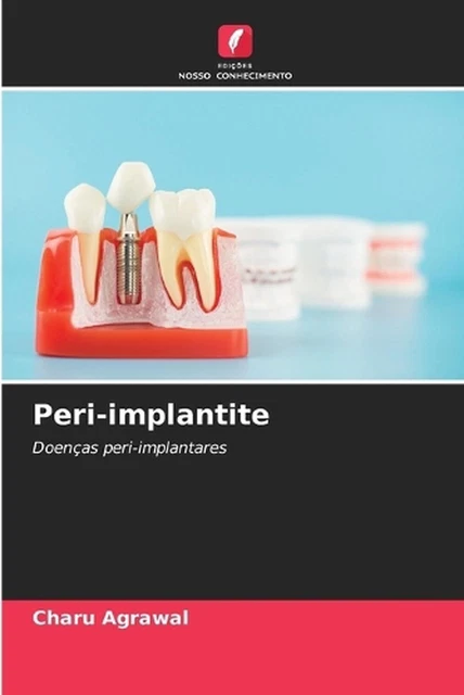 PERI-IMPLANTITE BY CHARU Agrawal Paperback Book EUR 108,58 - PicClick FR