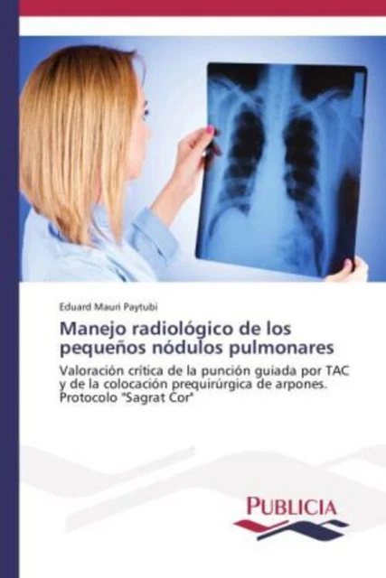 MANEJO RADIOLÓGICO DE los pequeños nódulos pulmonares Eduard Mauri ...