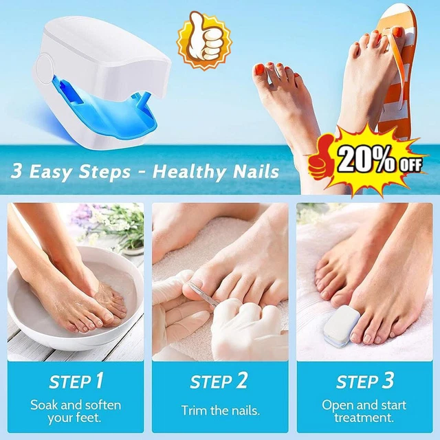 ANTI FUNGAL TREATMENT LASER-DEVICE FINGER TOE NAIL FUNGUS REMOVER ...