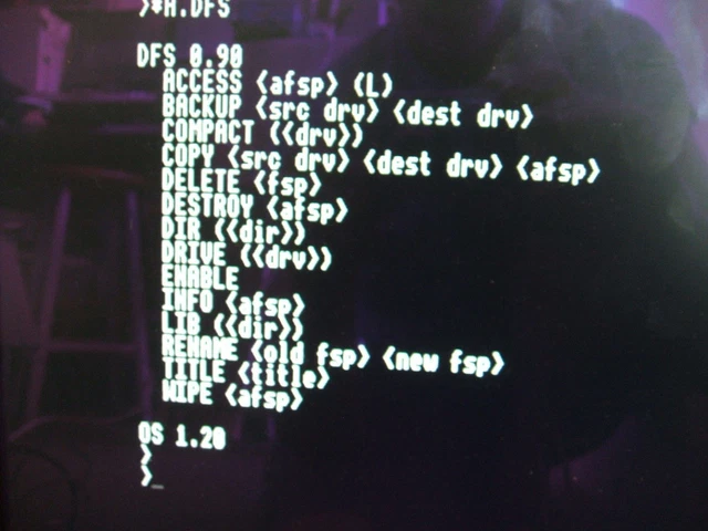 BBC MICRO MODEL B/Master Video converter/adapter HDMI output (with ...