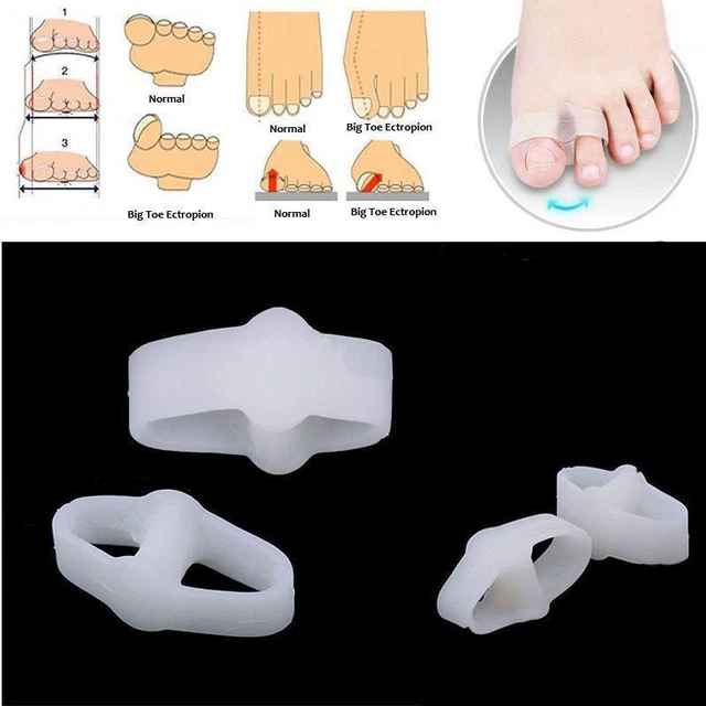 1 PAIRS SILICONE Gel Bunion Protector Toe Straightener Separator Pain ...