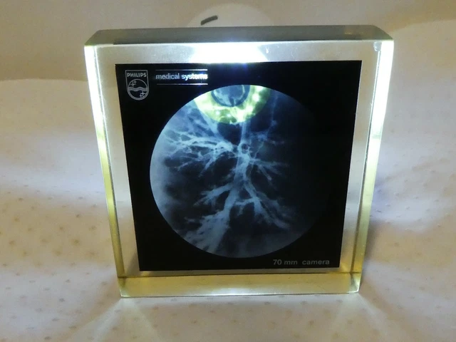 VINTAGE MEDICAL X-RAY Image Blood Vessels Lungs ? 70Mm Camera Philips ...