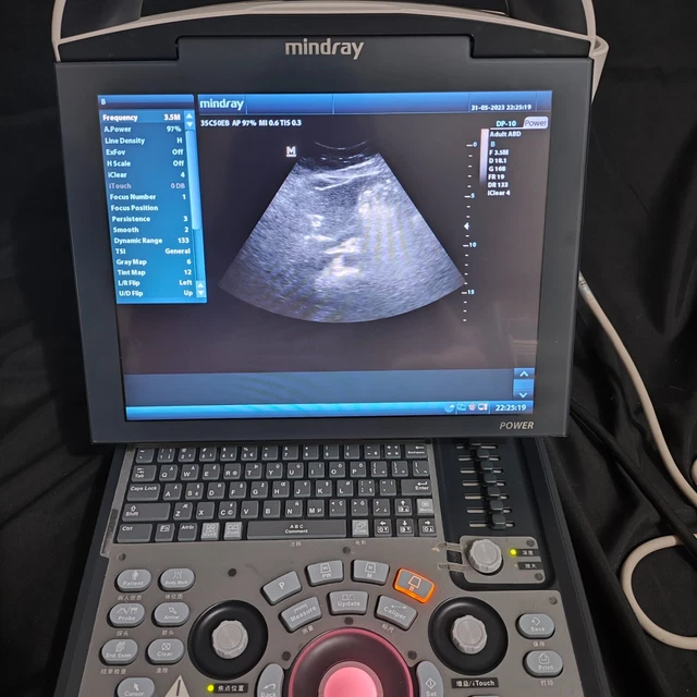 MINDRAY DP-10 PORTABLE BW Ultrasound Machine DP10 Mindray Cheapest ...