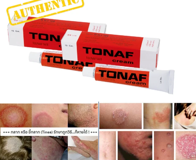 RACH ECZAMA RED Cream Itchy Scratch Skin Cream Scald Body Skin Spot X2 ...