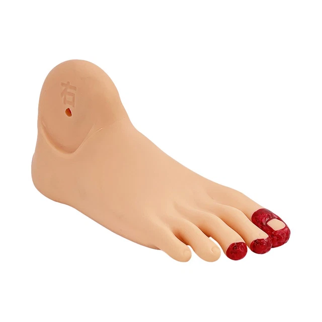 MODÈLE DE PIED diabétique Modèle de soins infirmiers pour le pied ...