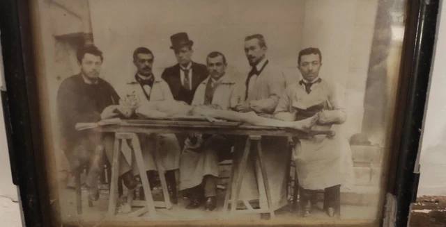 ANCIENNE PHOTO MÉDICALE Autopsie Cadavre Dissection cabinet card Corpse ...