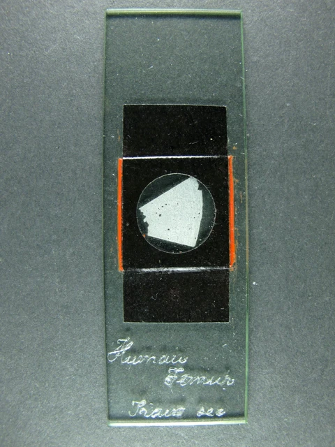 ANTIQUE MICROSCOPE SLIDE. "Human Femur. Trans section". Diamond ...